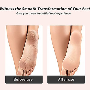 ICANdOIT-4 in 1 Foot File Callus Remover with Long Handle Classic Dry Brushing Body Brush Back Scrubber,Shower Brush for exfoliator Skin and Remove Dead Skin Cells