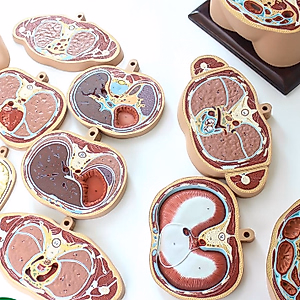 JOSBY Human Torso Cross-Section Model, CT, MRI Imaging Radiology Medical Model, 24pcs Human Body Cross-Section Image Anatomy, Each Layer is Removable, Used for Medical Teaching Display