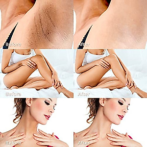 Natural Vine Dark Spot Corrector Cream, Dark Spot Remover for Body, Brightening Cream, Age Spot/Sun Spot/Brown Spot Remover, Dark Spot Cream, Instant Result, Moisturizes Armpit, Neck