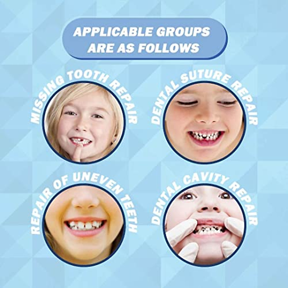 Racsoh Moldable False Teeth Repair Kit - Easy to Use Denture Adhesive with Calcium Carbonate for Cleaner, Whiter Teeth - Includes Tweezers - Improve Your Oral Health Today!