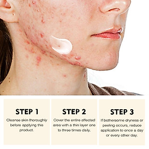 Acne Treatment for Face, Acne Cream Back Acne Treatment Cream for Teens & Adults Anti-acne Pimple Cream Butt Acne Clearing Cream, Acne Spot Treatment