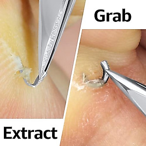 DUROX - Splinter Remover. Great For First Aid Kit Camping. Medical Tweezers To Tweeze Splinter Out. Splinter Remover Kit. Splinter Tweezers. Surgical Tweezers. First Aid Kit Tweezers…