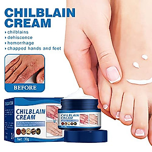 LONGLUAN Chilblain Cream, Anti-cracking Frostbite Moisturiser, Anti Crack Cream for Hands and Foot, Cracked Skin Repair Cream, Chapped Repair Cream, Deep Nourishing 30g (1)