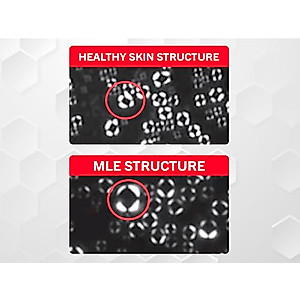 ATOPALM Intensive Moisturizing Cream for Dry & Sensitive Skin, Face Moisturizer, Replenishes Hydration, Paraben-Free, K-Beauty, skin barrier ceramide cream, 3.4 Fl Oz, 100ml (3.4 Fl Oz)