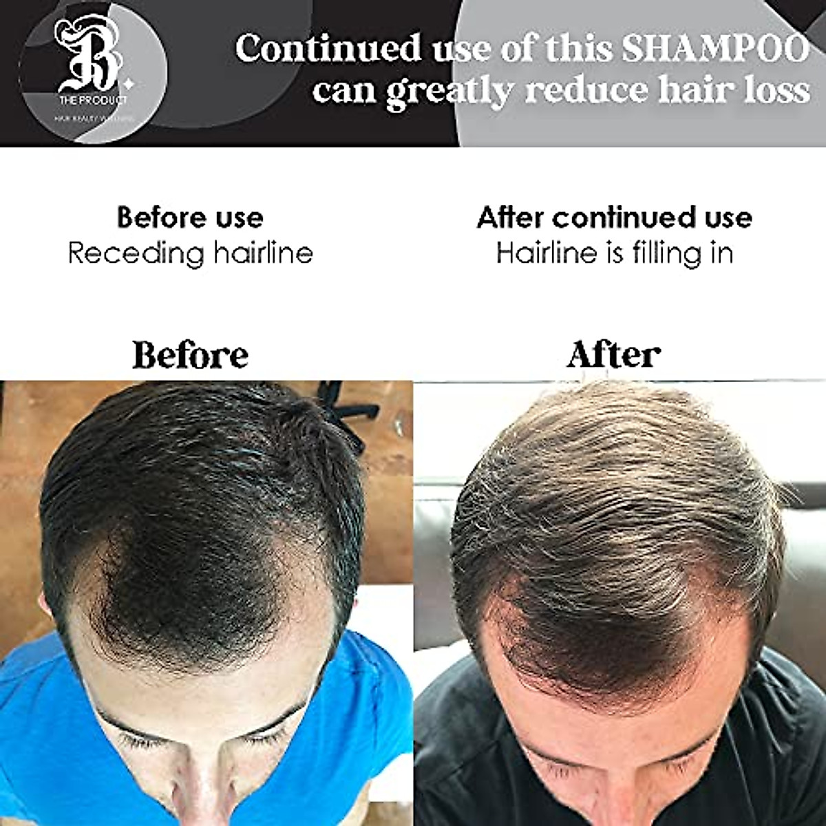 Biotin Vitamin Hair Shampoo for Thinning Hair - Volumizing Biotin Shampoo for Men and Womens Hair Thickener - Sulfate Free Shampoo with Aloe Vera and Cucumber Shampoo b the product 2oz