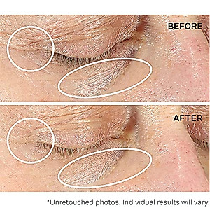 StriVectin Anti-Wrinkle Intensive Eye Cream Concentrate for Wrinkles PLUS, Targets Crow's Feet, Firmness, Puffiness & Dark Circles, 1 Fl oz