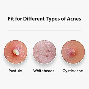 LitBear Acne Pimple Patches- Day and Night 4 Sizes 180 Dots Thin & Thick Hydrocolloid Patches with Witch Hazel, Tea Tree & Calendula Oil, Extra Adhesion Pimple Patches for Face Zit Patch Acne Dots