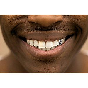 Solid 925 Sterling Silver Real Single Tooth Grillz - Grills Cap For Teeth - Real Solid Silver NOT Plated