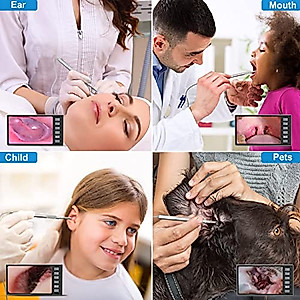 Digital Otoscope with 7 Inch IPS Screen, Hiacinto Ear Wax Removal Tool Camera, 3.9mm HD Ear Scope Otoscope with Light, Ear Camera and Wax Remover, Supports Photo Snap and Video Recording, 32GB Card