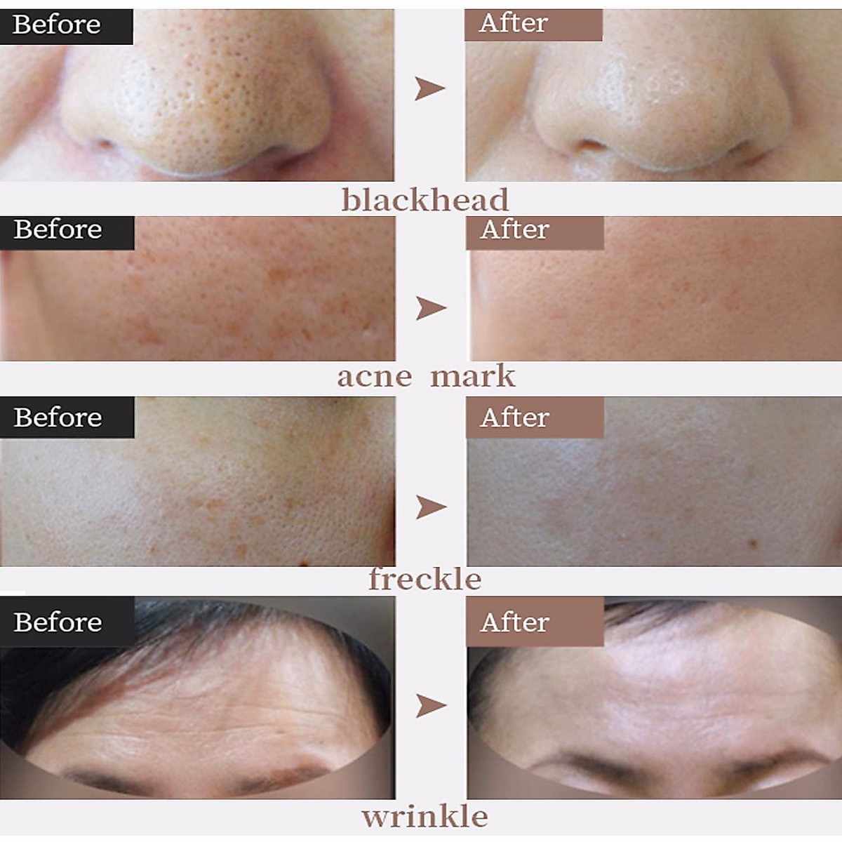 HBJH Led Face Mask Light Therapy, 7 led Light Therapy for Facial Skin Care - Blue & Red Light for facial oil Reduction and improve skin. (F-Masks-A)