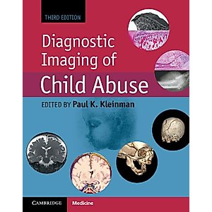 Diagnostic Imaging of Child Abuse