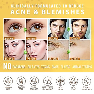 LILY SADO MILK+MANUKA™ Coconut Milk & Manuka Honey Gentle Gel Face Cleanser - Natural Cruelty-Free Facial Wash Cleanses, Balances, Soothes & Hydrates - Reduces Pores & Blackheads - 5oz