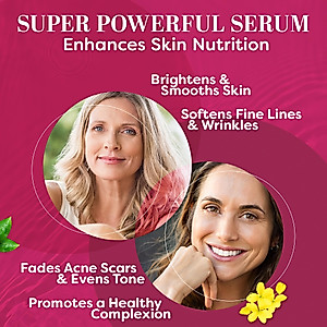 TruSkin Super C Duo with Vitamin C Plus Super Serum 1 fl oz & Vitamin C Brightening Moisturizer 2 fl oz – Anti Aging Skin Care Gift Set for Bright, Smooth, Firmer-Looking Skin