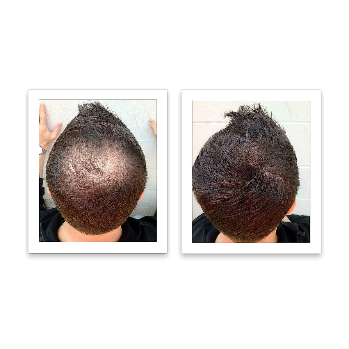 Caboki Hair Loss Concealer, 90-day supply, Dark Brown