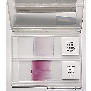 2pcs Human Blood Smear, HE Stain & Wright's Stain, for Observation of Red and White Blood Cells