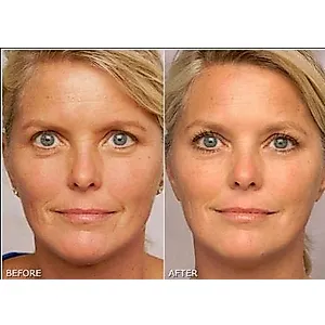 Retinol Gel 0.1 Vitamin A Repairs Fine Lines & Wrinkles, Scar Treatment, Age and Sun Spots, Anti-Aging Formula , 20 Grams