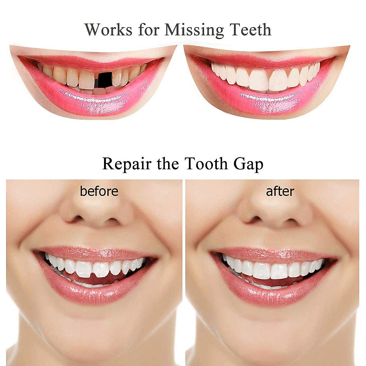 Tooth Repair Kit-Thermal Beads for Filling Fix The Missing and Broken Tooth or Adhesive The Denture Fake Teeth