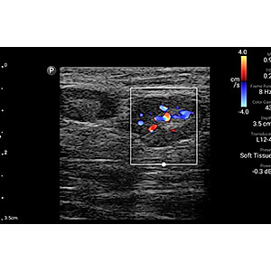 Philips FUS6882 Lumify L12-4 Linear Array Transducer, Portable Ultrasound Solution