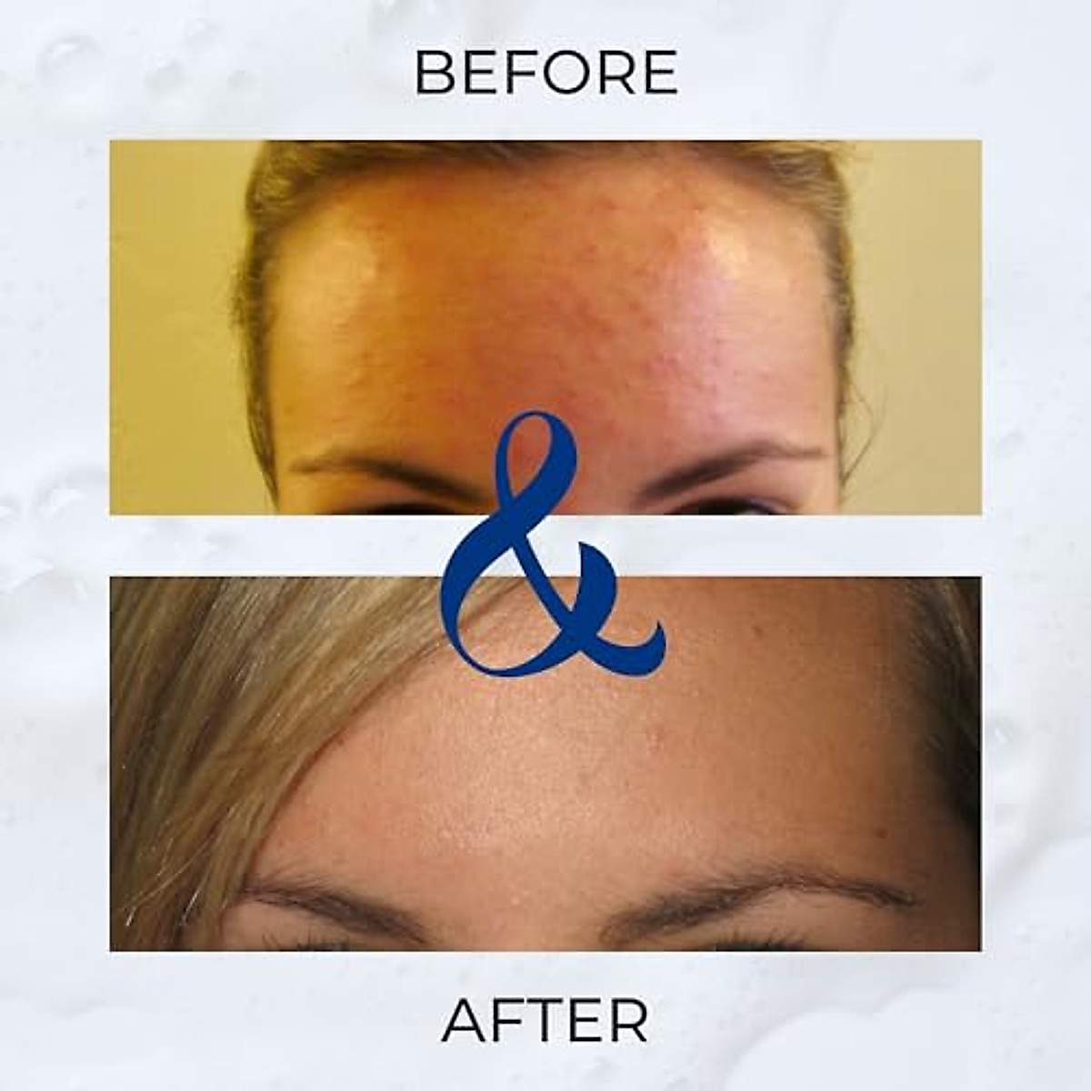 Non-Comedogenic Clear 2 Perfection Shampoo - Sulfate & Paraben-Free for Clear, Healthy Skin & Hair - Esthetician Formulated