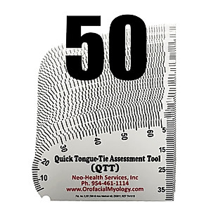 Quick Tongue Tie Assessment