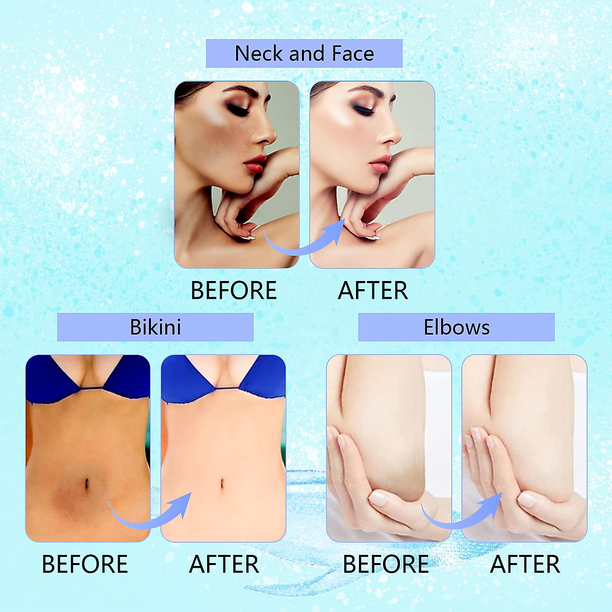 Body Intimate Area Dark Remover For Underarms, Armpit, Knees, Elbows, Inner Thigh, bikini Dark Area Corrector Cream With Natural-Ingredients Designed By USA