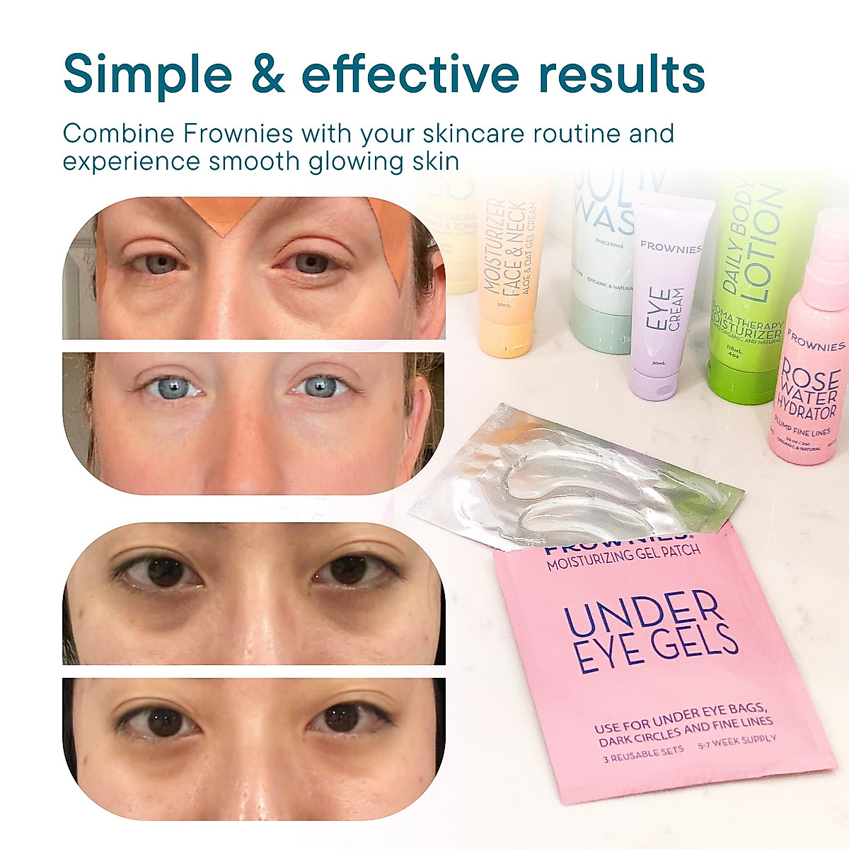 Frownies Under Eye Gel Patches for Puffy Eyes - Dark Circles with Cactus Collagen - Reusable, 3 Pack