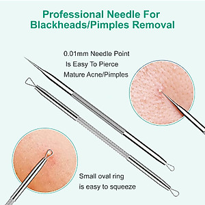 Blackhead Remover Tool,lalasis 5 Pcs Pimple Popper Tool Kit，Blackhead Extractor Tool for Face Comedone Zit Acne Whitehead Blemish Popping Stainless Steel Extraction Tools Set
