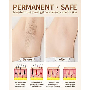 GERCY Laser Hair Removal for Women Permanent, Painless At-Home IPL Hair Removal Device Upgraded to 999,999 Flashes, 5 Level Energy Adjustable & 2 Flash Modes for Beautify Skin, Face, Body, Bikini