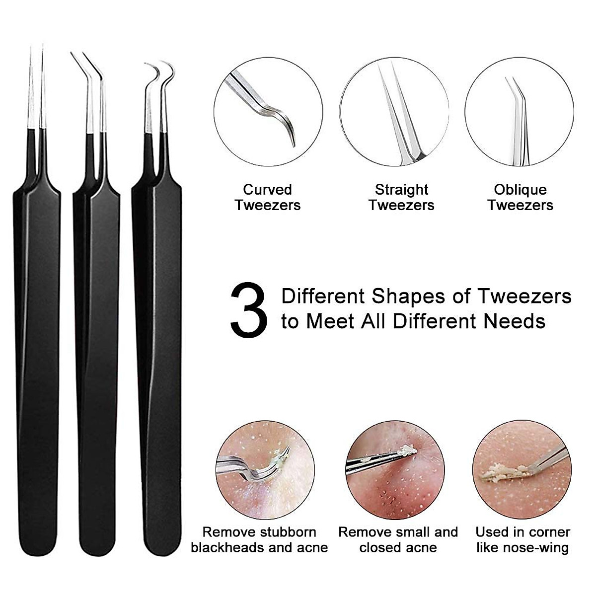 Pimple Popper Tool Kit, Aooeou 10 Pcs Professional Blackhead Extractor with Metal Case - Easy Removal for Pimples, Blackheads, Zit Removing, Forehead and Nose(Black)