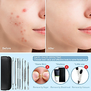 Teenitor 7 in 1 Pimple Popper Tool Kit Blackhead Remover Tools Blackhead Extractor, Pimple Extractor Pimple Popper Tool Zit Popper Tool Acne Tools Comedone Extractor Black Head Remover for Face