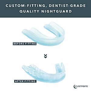 CUSTMBITE Premium Hard Surface Night Guards for Teeth Grinding, 2 Pack with Mouth Guard Case, USA Made, Mouth Guard for Clenching Teeth at Night, Bruxism NightGuard - Customizable Fit Dental Guard