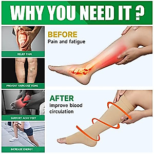 MGANG Compression Socks, 15-20 mmHg Graduated Knee High Compression Stockings for Unisex, Class I, Open Toe, Opaque, Support Hose for DVT, Pregnancy, Varicose Veins, Relief Shin Splints, Beige L