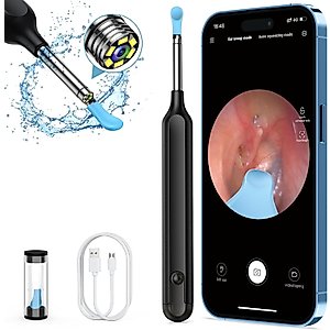 Earwax Camera Ear Camera Otoscope Cleaner, Oxbird 1080P Wireless Ear Wax Removal Kit Smart Ear Cleaner with Camera and Light for iPhone, Ipad & Android Smart Phones (Black)