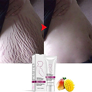 Stretch Mark Cream For Pregnancy Repair Scar Slack Line Abdomen Stretch Marks Cream, Remove Stretch Marks From Pregnancy, Repair Scar Slack Line Abdomen Stretch Marks Postpartum