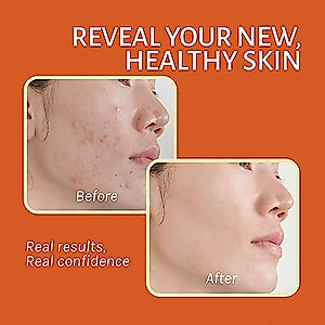 Swell Skin - Sea Buckthorn Oil for Skin Health, Facial Oil, Age-Defying Beauty Potion, Moisturizing Face Oil, Also Works on Bites & Burns, 30 ml