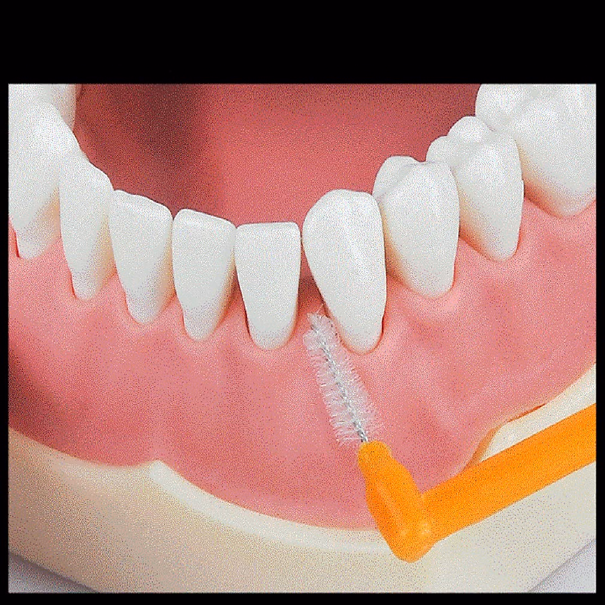 Curved interdental Brush, 10 Count 2bags， 0.7mm (SSS,Yellow)…