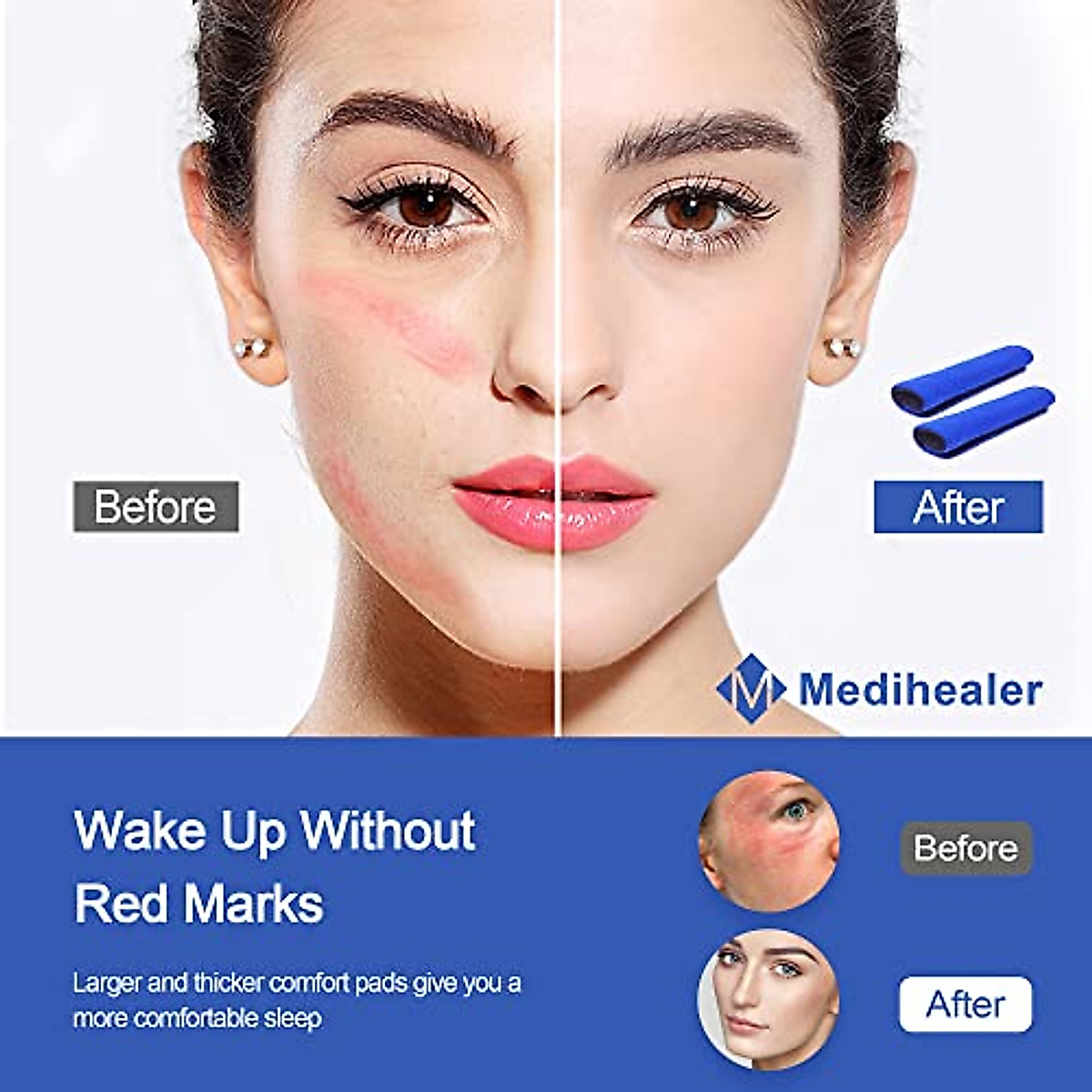 8 Pack CPAP Headgear Strap Covers, Universal and Reusable Strap Covers, Soft-Fleece Strap Pads, Reduce Red Marks, Great Value Kit Supplies by Medihealer