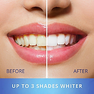 Mentadent Teeth Whitening Gel Pen for Sensitive Teeth, Pack of 2 Easy to Use Teeth Whitener | Dental Products for Beautiful Bright White Teeth & Smile