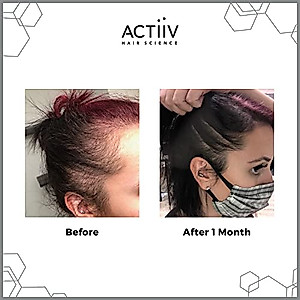 Actiiv Actiiv Recover Thickening Conditioner 5 Oz, 5 Oz