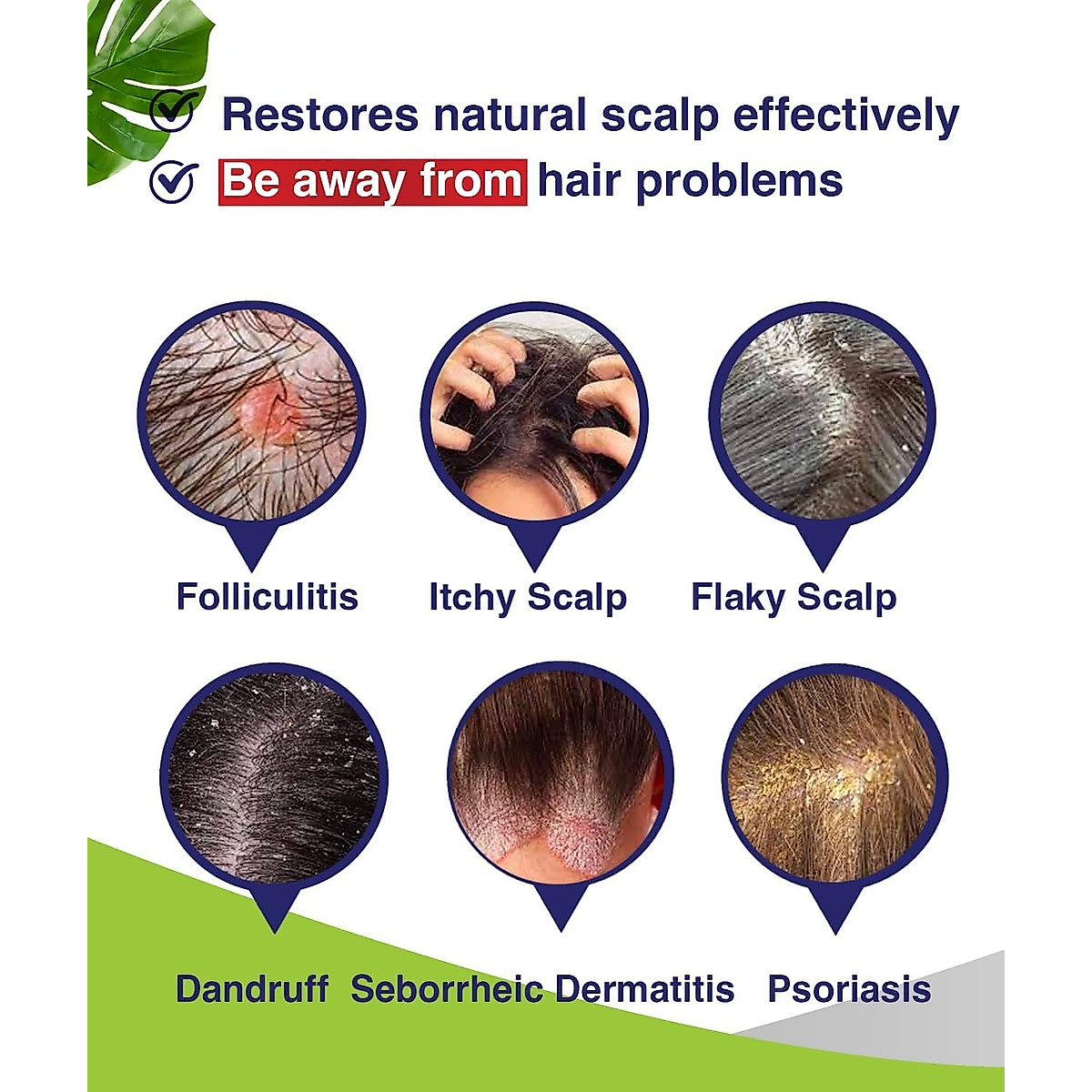 PHARMBANNER Anti-Fungal Shampoo for Folliculitis, Seborrheic Dermatitis, Scalp Psoriasis - Relieves Itchy & Dry Scalp