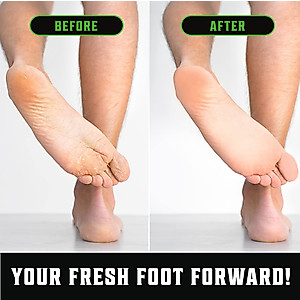 Viking Revolution Skin Cleaning Agent Tea Tree Kit for Men - Tea Tree Oil Set with Body Wash & Balm - Hydrating, Helps Athlete's Foot, Jock Itch, Eczema & Body Odors - Extra Strength, 2 Piece Set