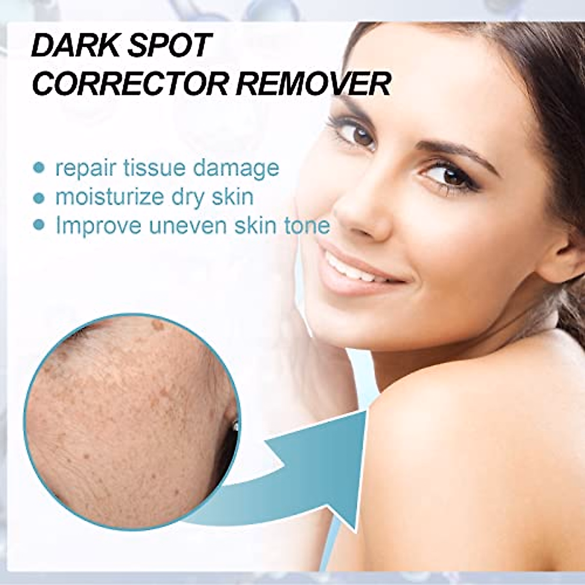 3Pack Musely Dark Spot Cream,Dark Spot remover for Face,The Spot Cream for Face,Dark Spot Correct Cream, Freckle Remover and Discoloration Correcting Serum