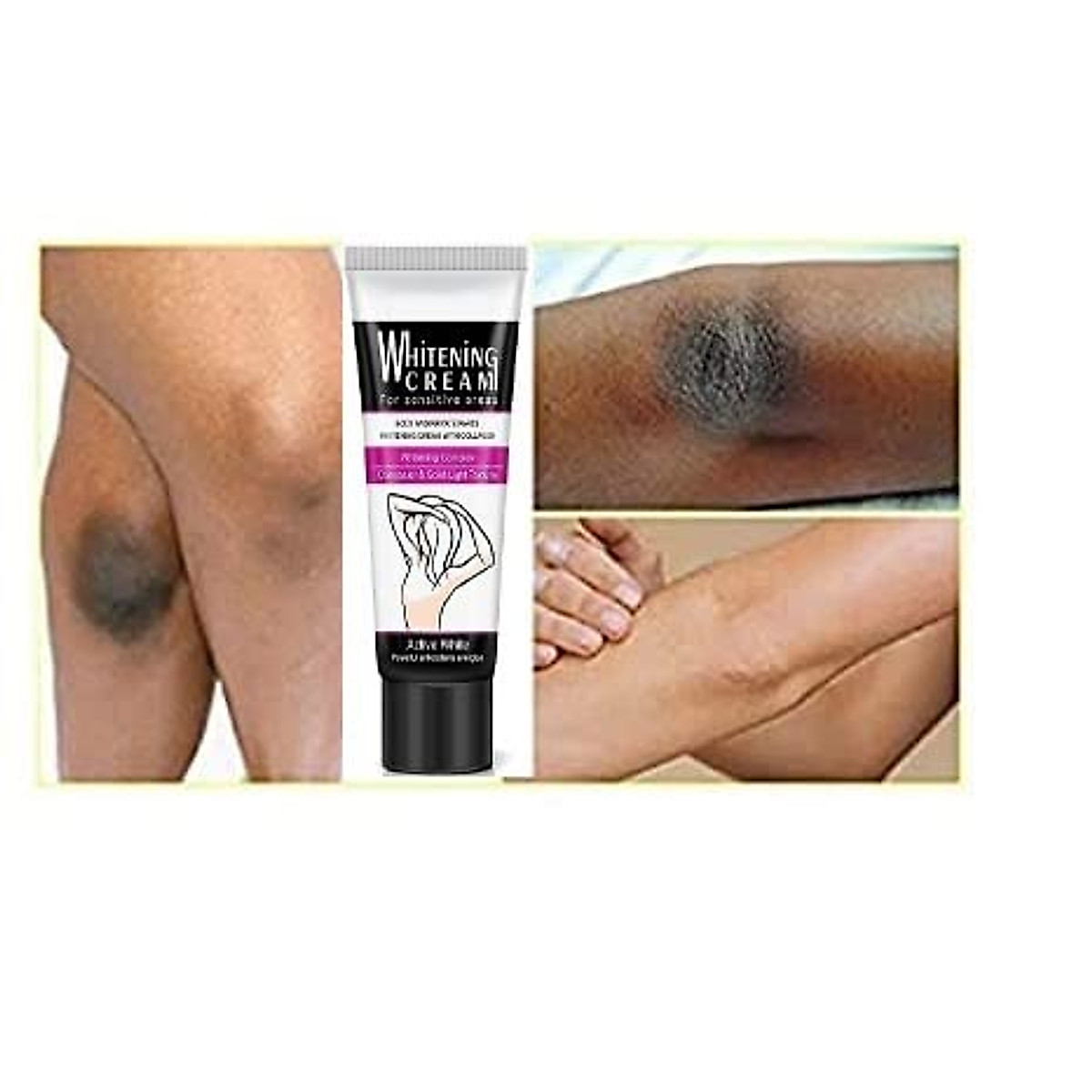 TOWELL Crema Aclaradora Para Piel Manchas En Cara Axilas Cuello Entrepierna