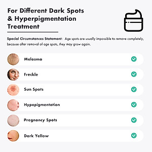 ASHUDAN Dark Spot Remover for Face, Dark Spot Corrector Cream, Sun Spot, Melasma, Freckle, Age spot Removal for Women and Men | Improves Hyperpigmentation - 1.7 Fl Oz