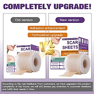 Silicone Scar Sheets,Silicone Scar Tape,Scar Tape For Surgical Scars,Silicone Scar Removal Strips For Surgical,C-Section,Tummy Tuck,Keloid Scars(1.6"X 59" Roll-1.5M) Keloid Bump Removal