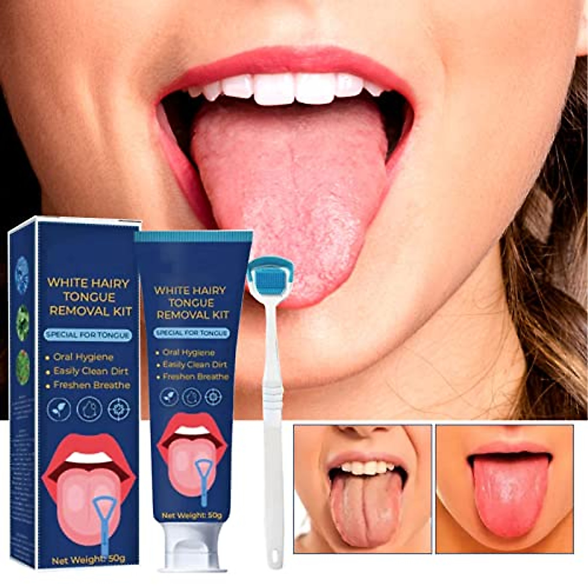 Tongue Cleansing Gel, 50g Ergo Handle 2 Pcs Oral Refreshing Tongue Scrubber Brush Adult Plaque Removal Kit for Bad Breath
