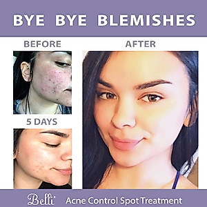 Belli Skincare Acne Control Spot Treatment - Skin Care Treatment - Acne Treatment - Vegan Face Wash - Pregnancy Acne Treatment - Acne Spot Treatment for Face - Face Care
