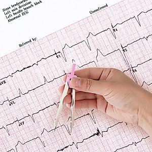 DSLSQD EKG Calipers ECG Calipers Measuring Tool with Ruler EKG Caliper Divider for Measuring Electrocardiographs Nurse or Doctor Electrocardiogram Measuring Tool for Nursing (Pink)