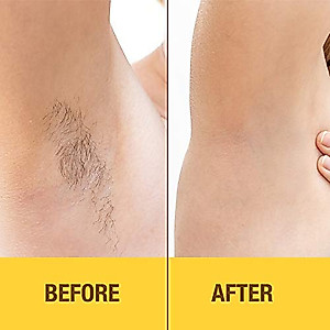 GiGi Microwave Hair Removal Wax, All Purpose Honee, with Essentials