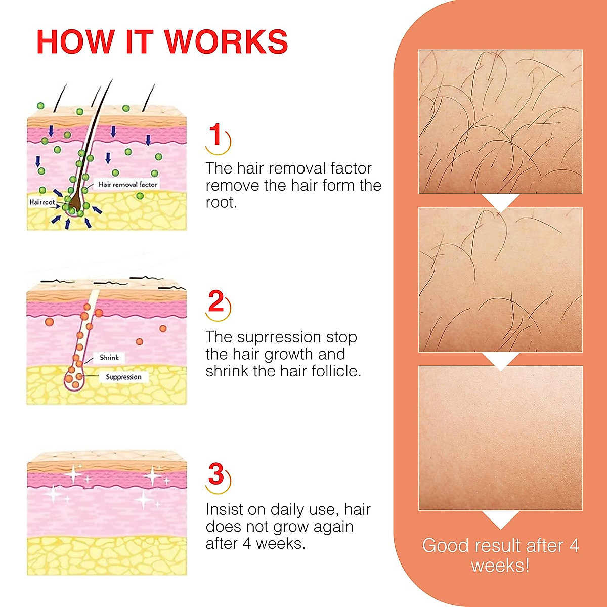 LOVOOD Hair Growth Inhibitor Spray - Non-Irritating & Painless for Face & Body, 1.01 Fl Oz (Pack of 1)